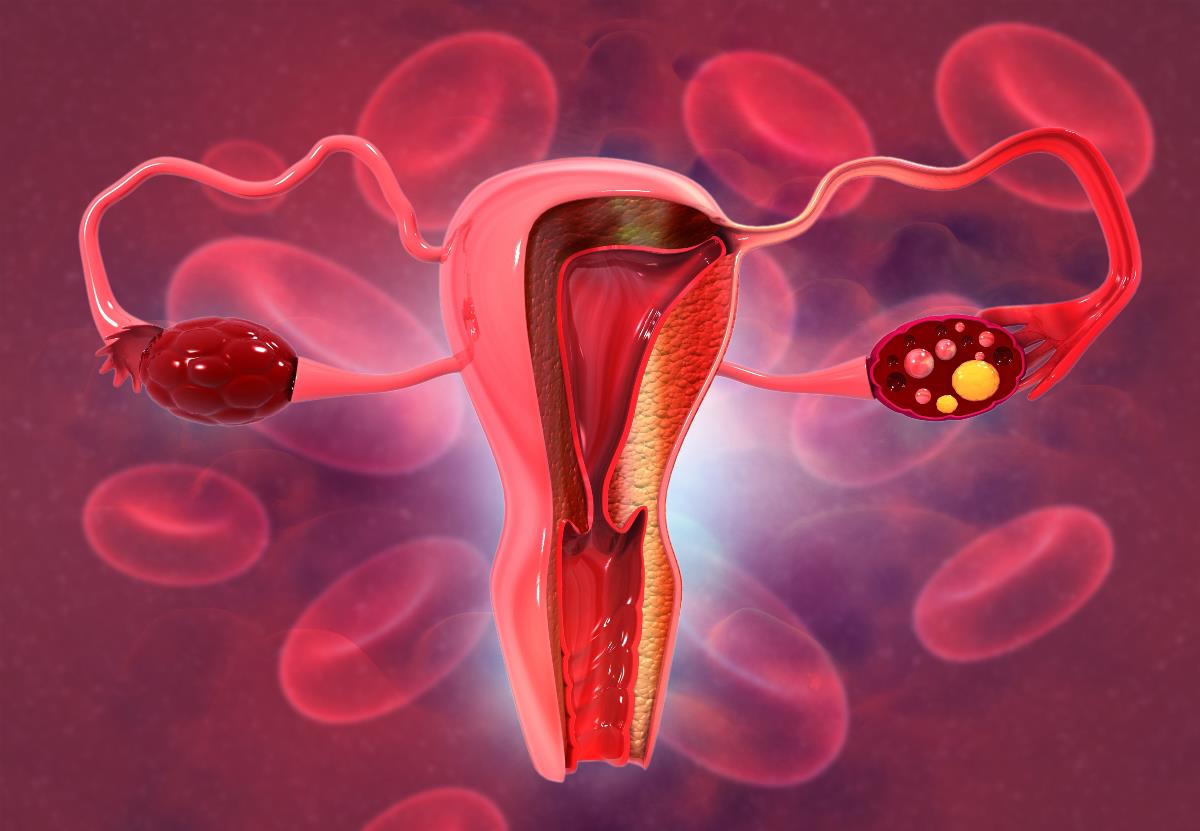 Coágulos en la menstruación: Descubre lo que significa y cómo tratarlos ...
